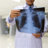 Rontgen Thorax di Amalia Medical Center | HDmall