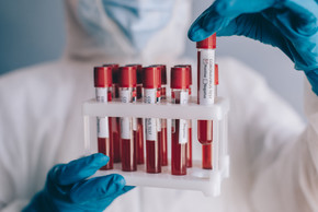 Pemeriksaan Trombosit di Pertama Lab | HDmall