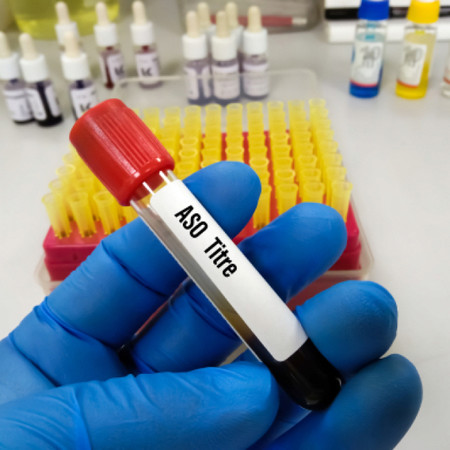 Pemeriksaan Jantung (ASO/ASTO Kuantitatif/Titer) di Amalia Medical ...