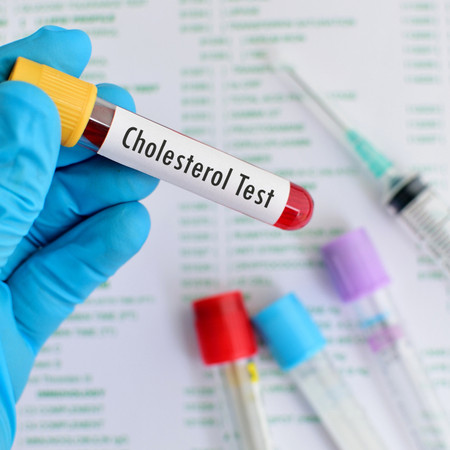 Pemeriksaan Kolesterol Total di Amalia Medical Center | HDmall