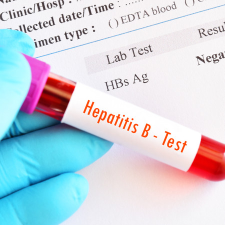 Pemeriksaan HbeAg di Pertama Lab | HDmall