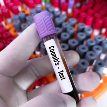 Pemeriksaan Coombs Test di Amalia Medical Center | HDmall