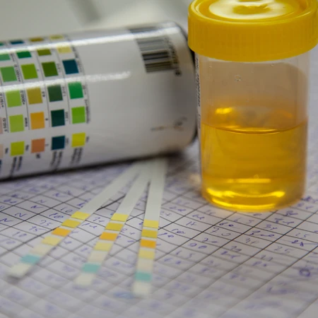 Pemeriksaan Paru-paru (M.TBC Swab PCR Urine) di Amalia Medical Center ...