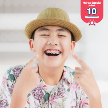 Pasang Behel Sapphire oleh drg. Spesialis Ortodontik di Dentistique ...