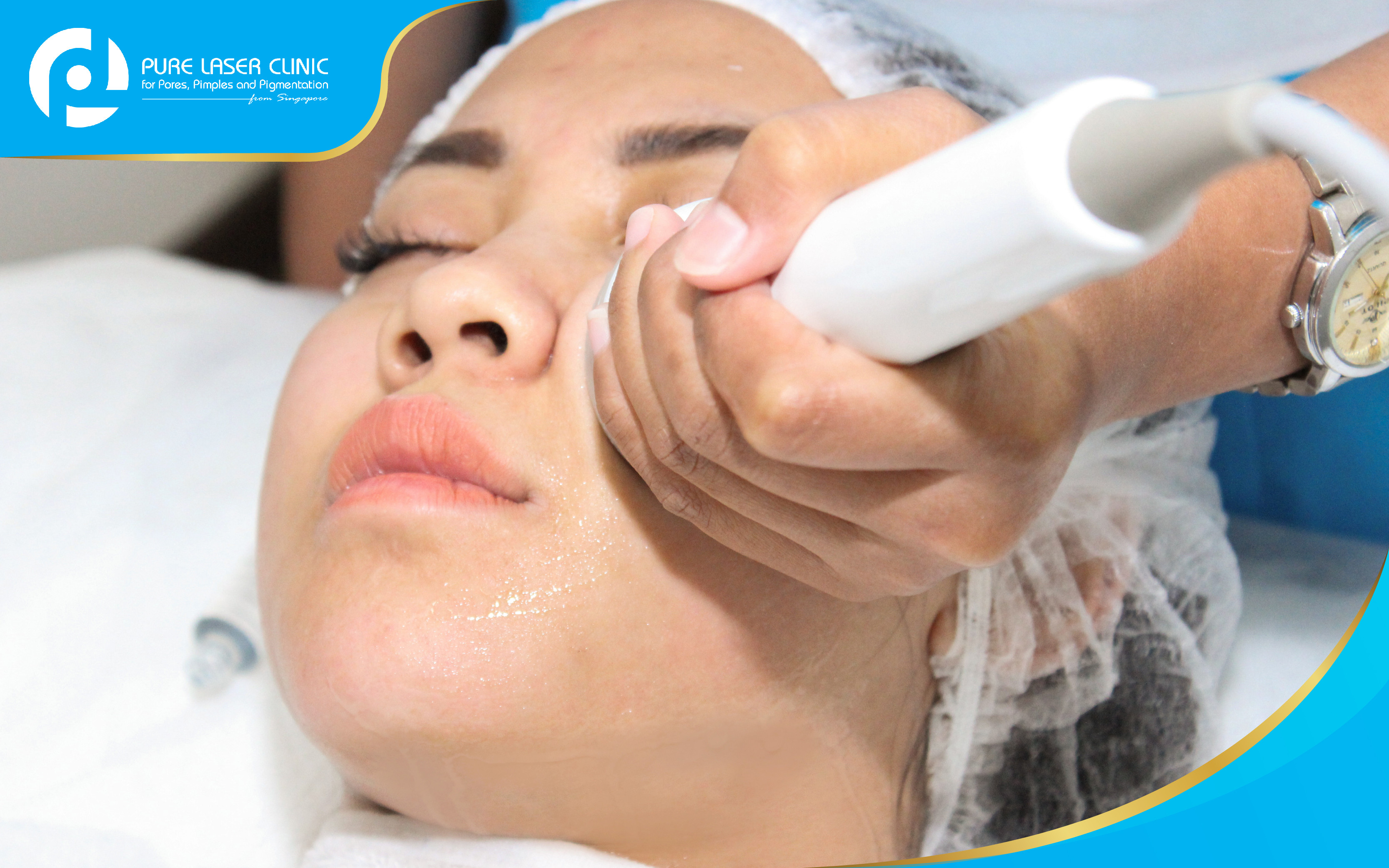 V-Shaped Face Contouring dengan Radio Frequency di Pure Laser Clinic ...