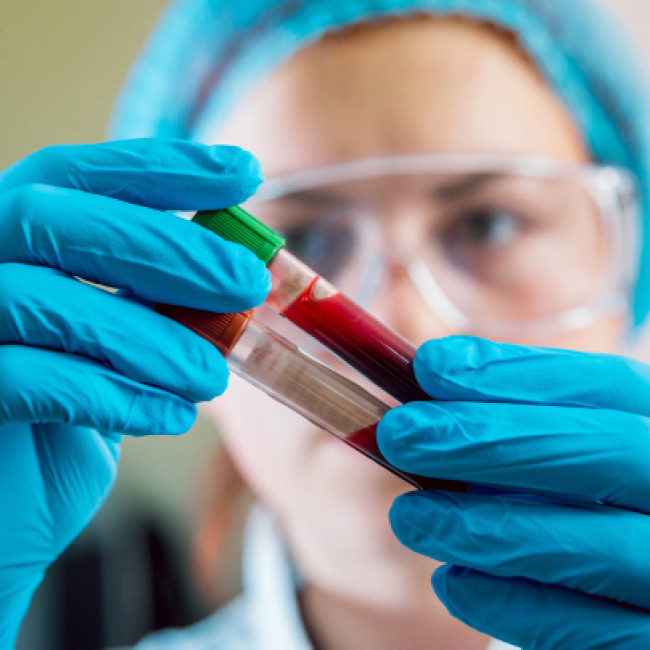 Pemeriksaan ANA IF ( Titer ) di Amalia Medical Center | HDmall