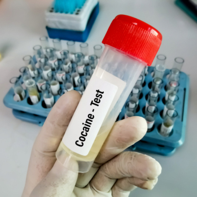 Pemeriksaan Cocaine ( Screening Test ) di Amalia Medical Center | HDmall