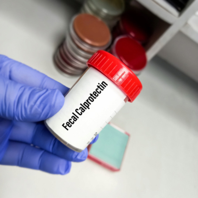 Pemeriksaan Fecal Calprotectin di Amalia Medical Center | HDmall
