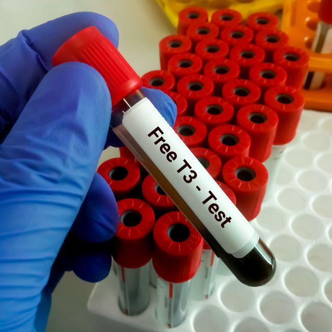 Pemeriksaan Free T3 di Amalia Medical Center | HDmall