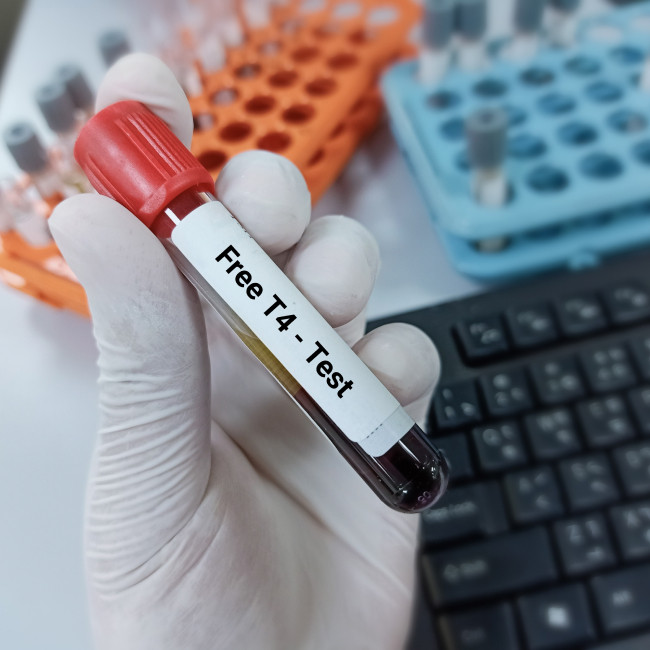 Pemeriksaan Free T4 di Amalia Medical Center | HDmall