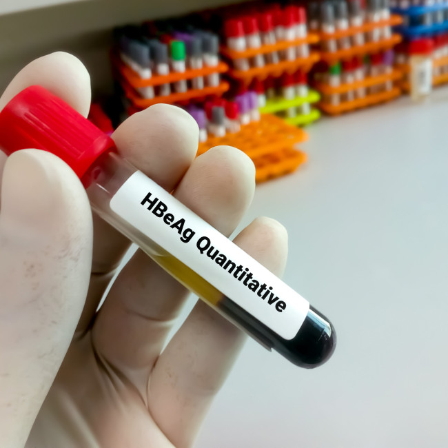 Pemeriksaan Hati (Hbe Ag) di Amalia Medical Center | HDmall