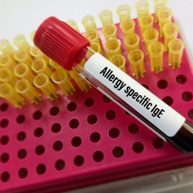 Pemeriksaan Panel IgE Spesifik (54 Jenis) di Amalia Medical Center | HDmall
