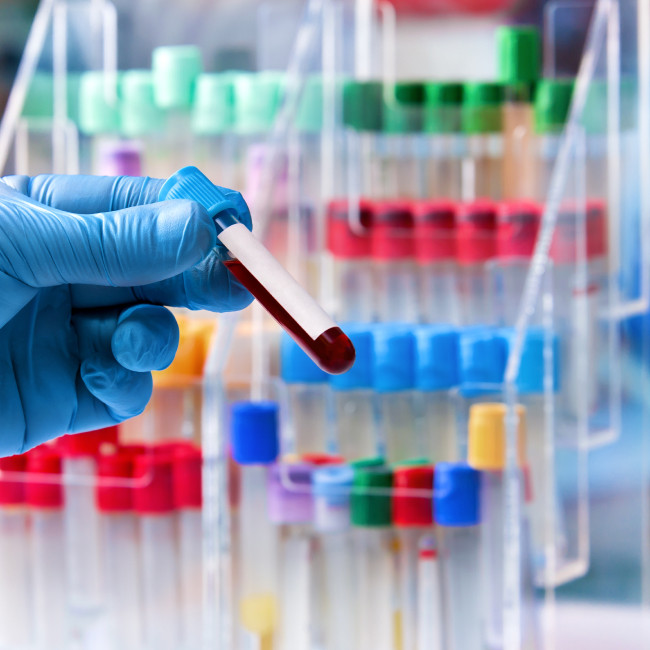 Pemeriksaan Darah Lengkap di FastMed | HDmall