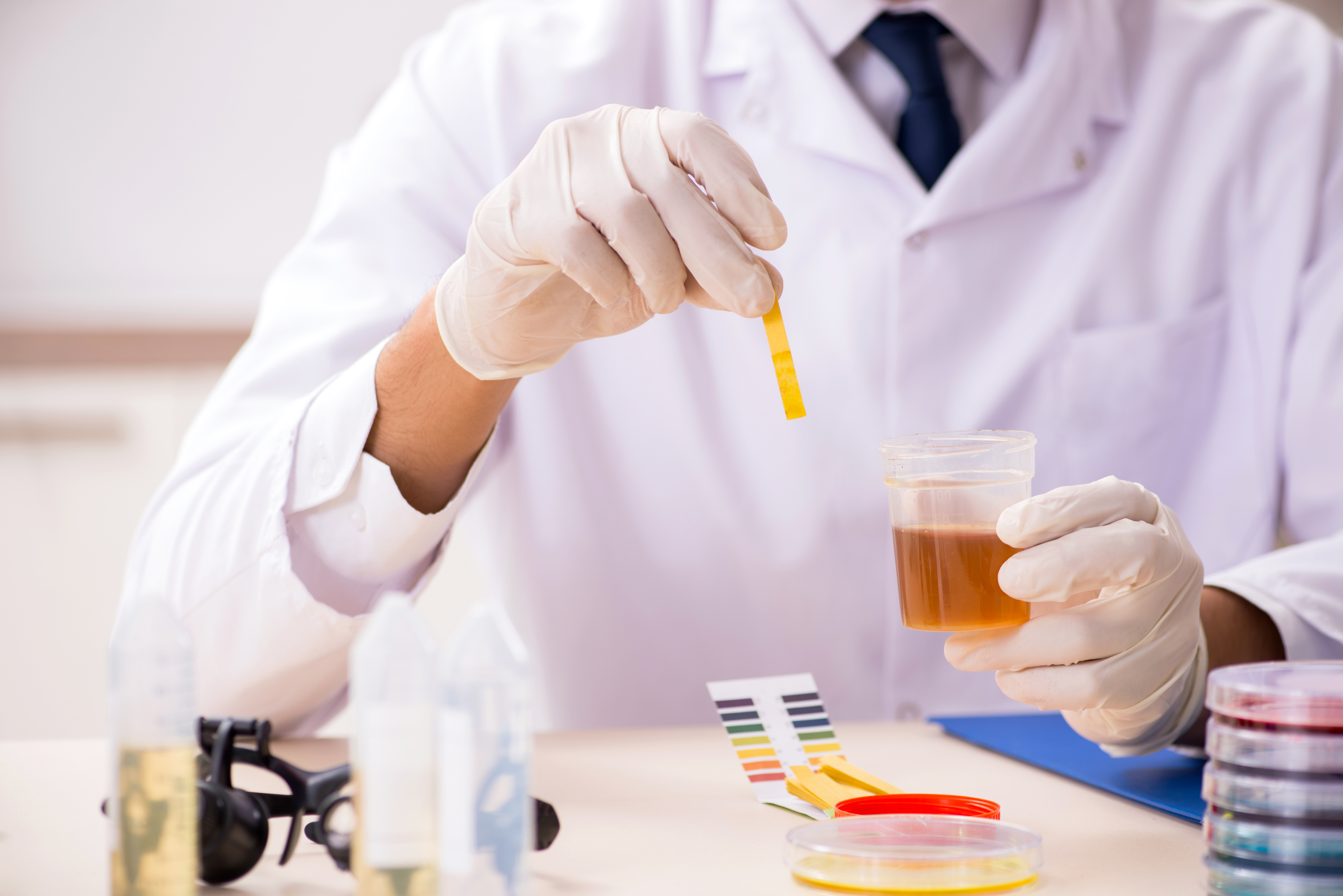 Pemeriksaan Urine Lengkap di Pertama Lab | HDmall