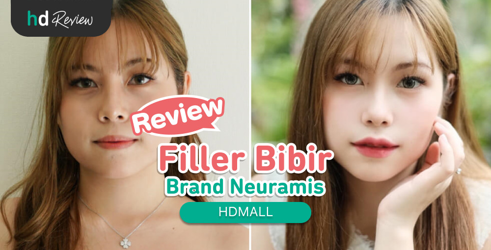 Review Filler Bibir, Senyum Makin Menawan dan Percaya Diri | HDmall