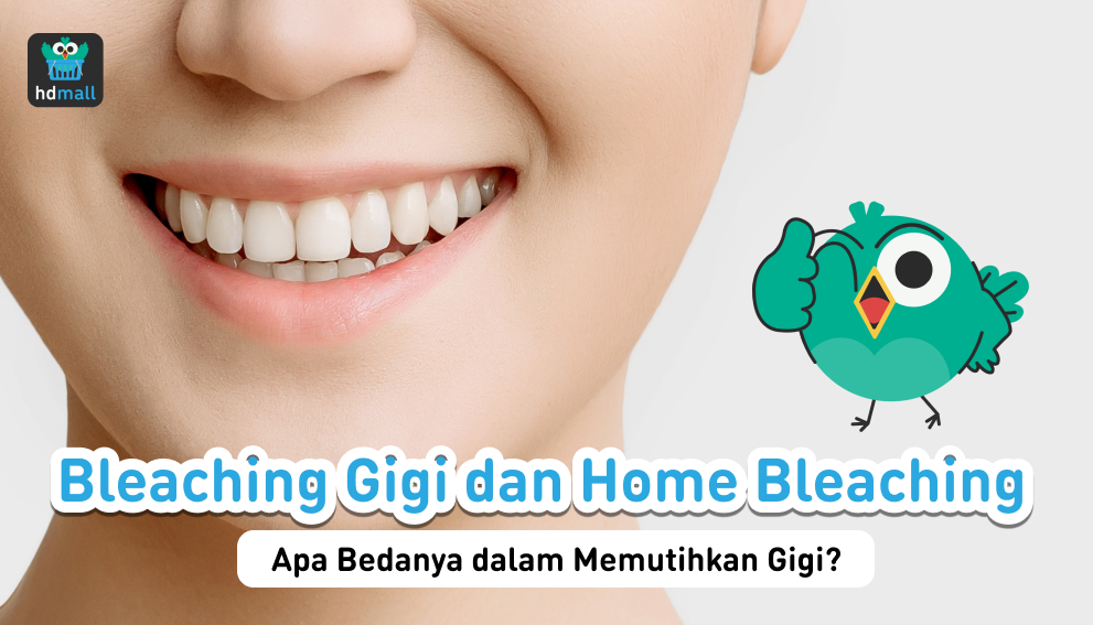 Apa sih Bedanya Bleaching Gigi dan Home Bleaching? | HDmall