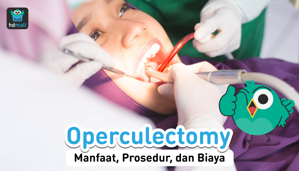 Operculectomy: Manfaat, Prosedur, dan Biaya Perawatan | HDmall