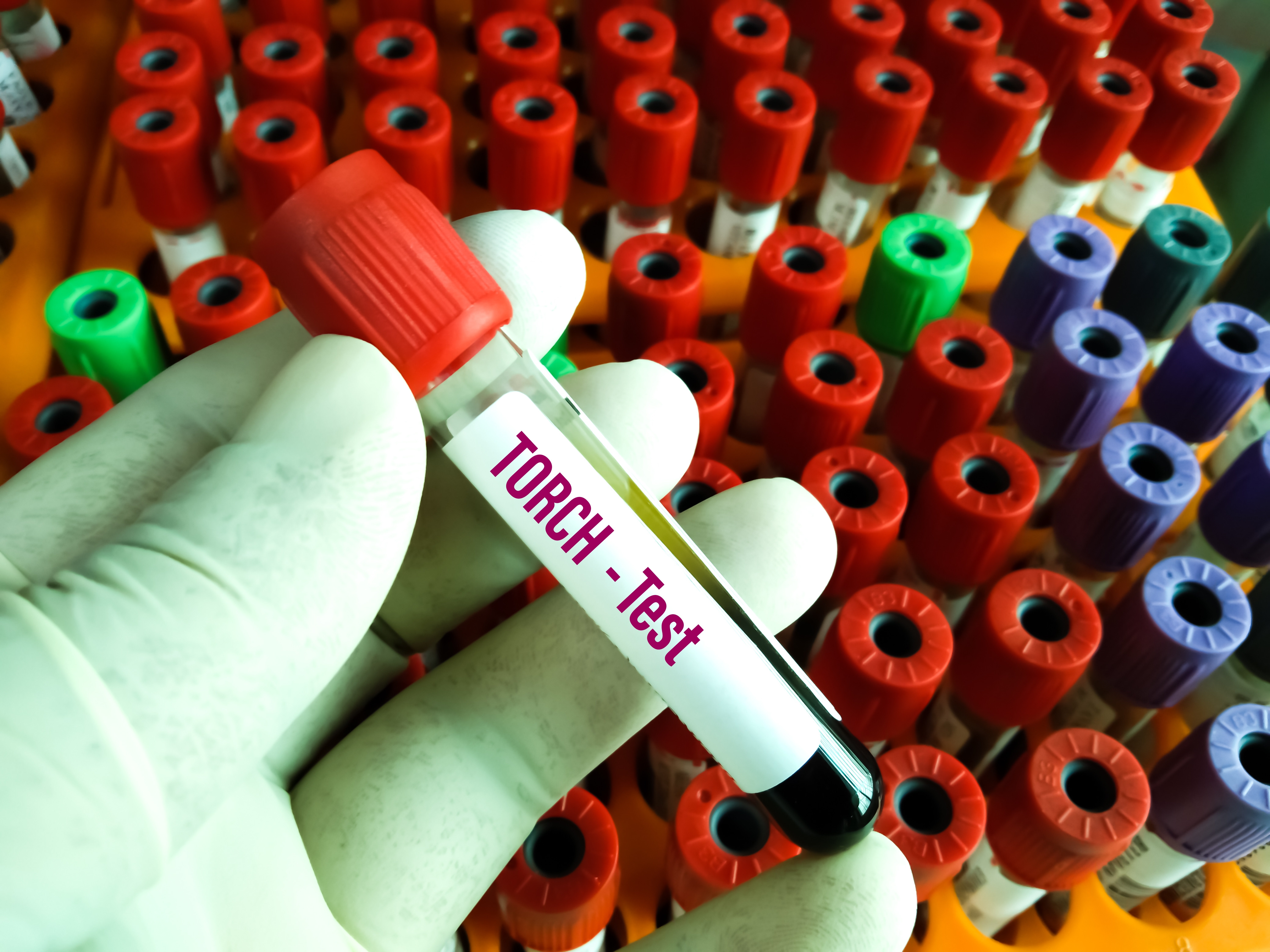 Paket Pemeriksaan Torch di ProLab-Ku | HDmall