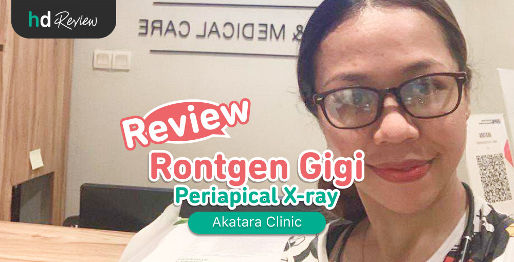 Review Rontgen Periapikal di Akatara Clinic | HDmall