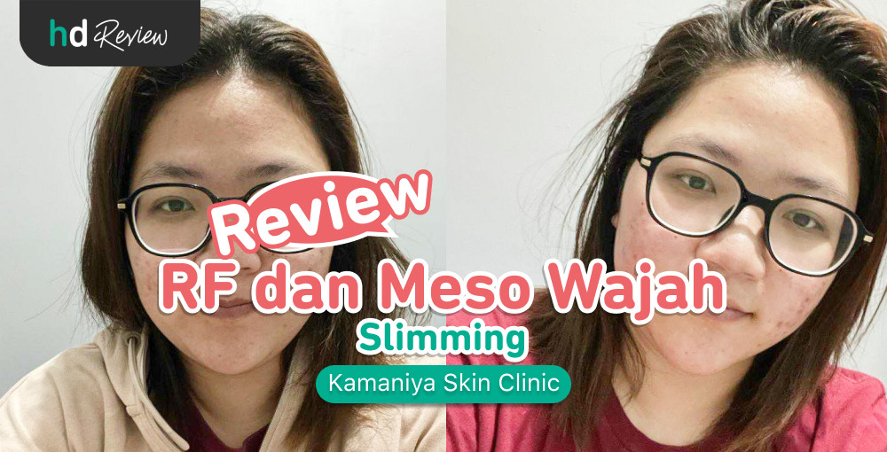 Review Slimming dengan RF dan Meso Wajah di Kamaniya Skin Clinic | HDmall