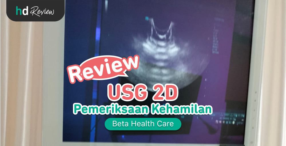 Review USG 2D di Beta Health Care | HDmall