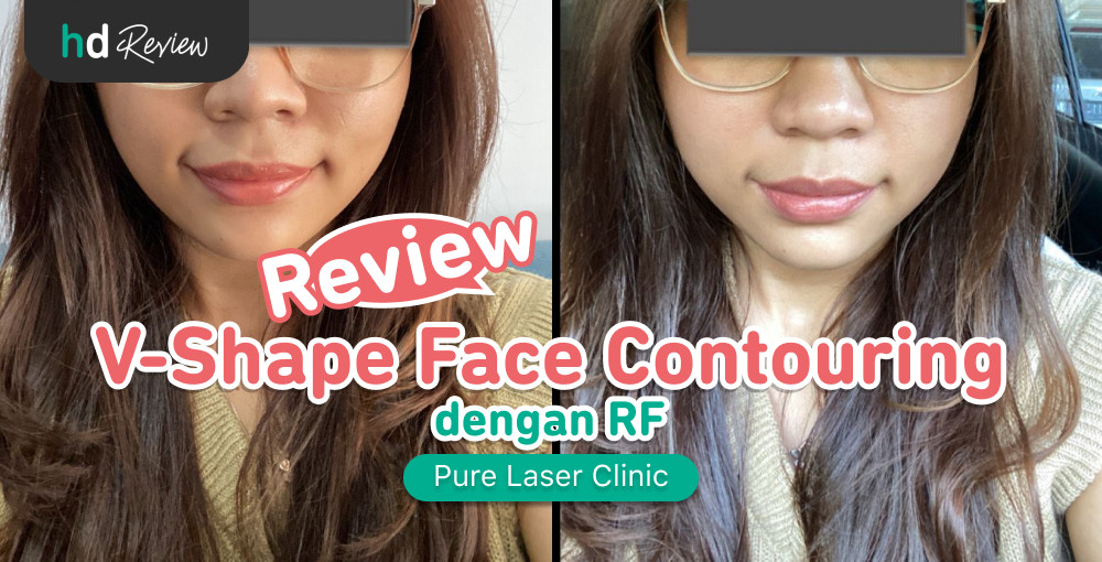Review V-Shape Face Contouring di Pure Laser Clinic | HDmall
