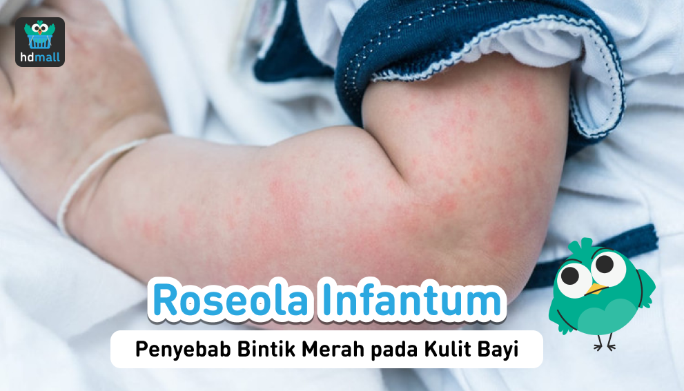 Roseola Infantum, Penyebab Bintik Merah pada Kulit Bayi | HDmall