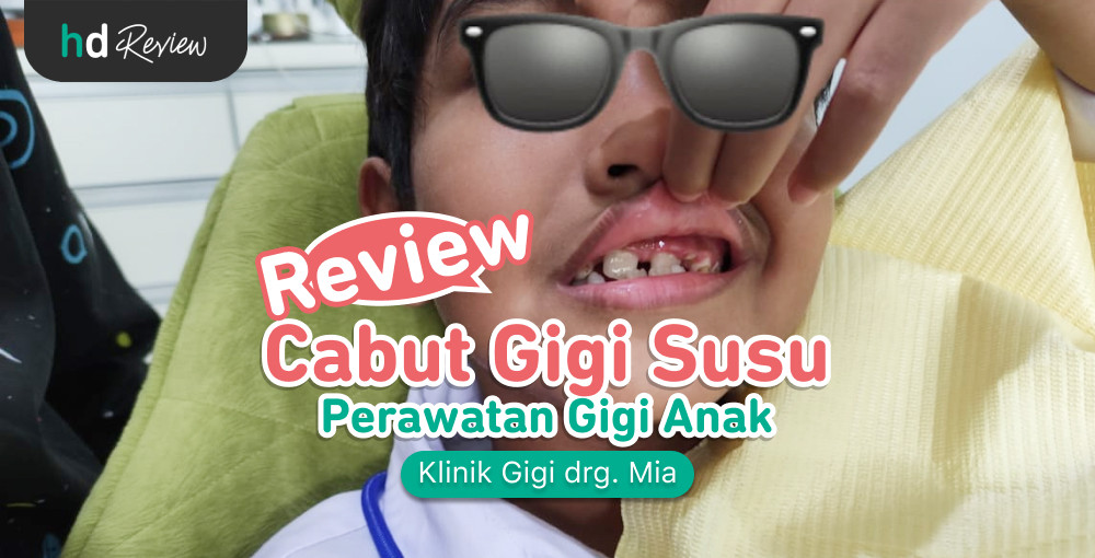 Review Cabut Gigi Susu Anak di Klinik Gigi drg. Mia | HDmall
