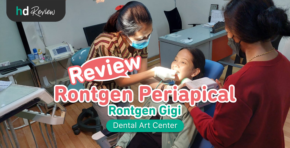 Review Rontgen Periapical di Dental Art Center | HDmall