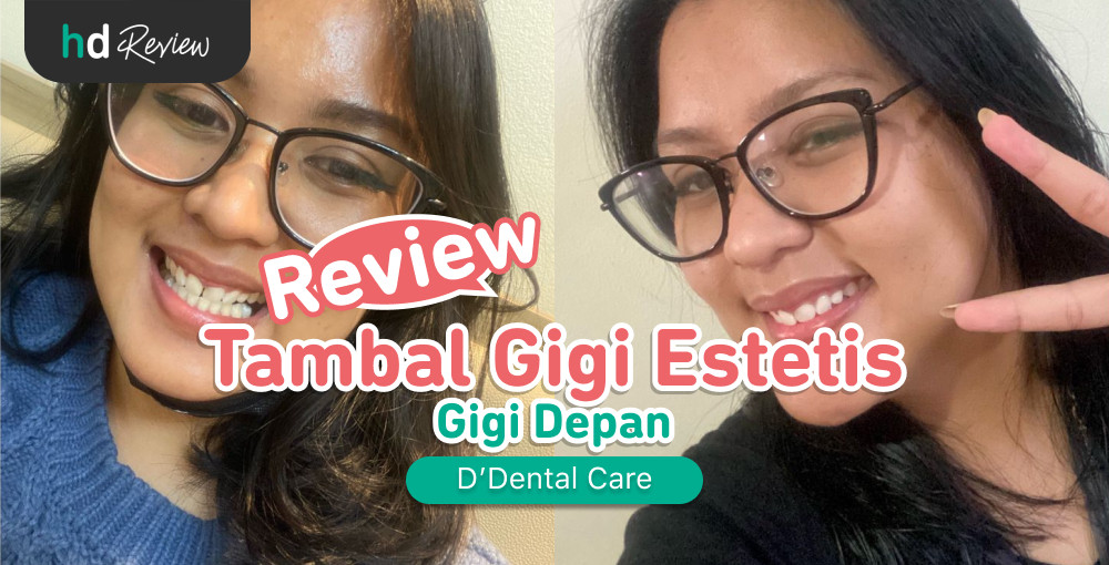 Review Tambal Gigi Estetis di D'Dental Care | HDmall