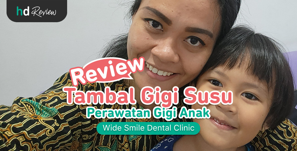 Review Tambal Gigi Susu di Wide Smile Dental Clinic | HDmall