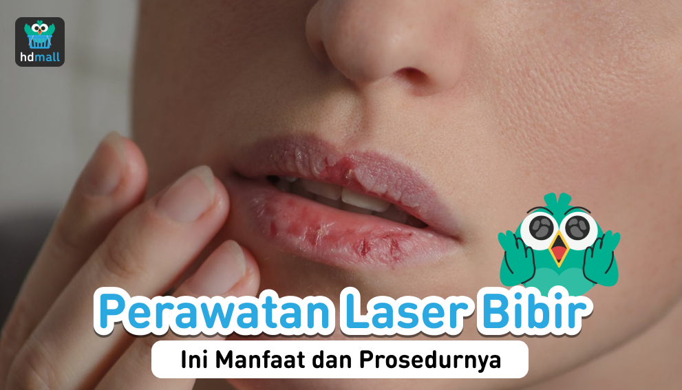 Manfaat dan Prosedur Laser Bibir untuk Perawatan Bibir Hitam | HDmall