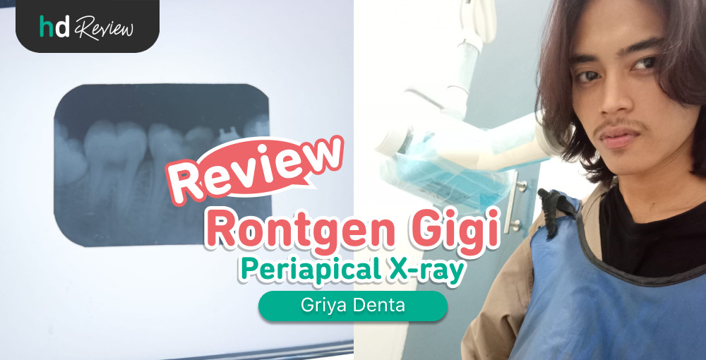 Review Rontgen Periapical di Griya Denta | HDmall