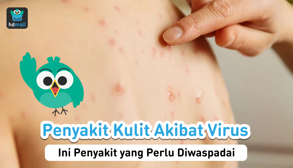 7 Penyakit Kulit Akibat Virus yang Perlu Diwaspadai | HDmall