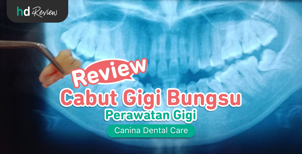 Review Cabut Gigi Bungsu di Canina Dental Care | HDmall