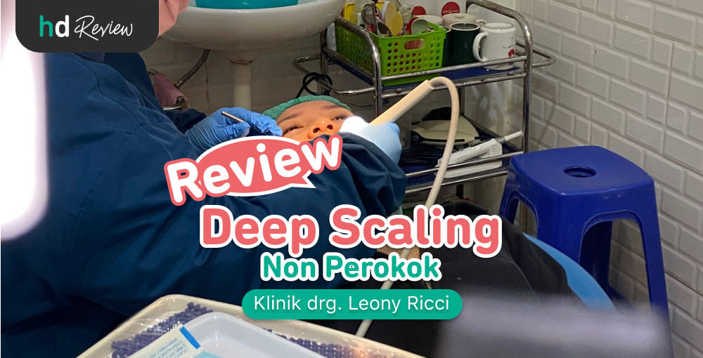 Review Deep Scaling di Drg. Leony Ricci | HDmall