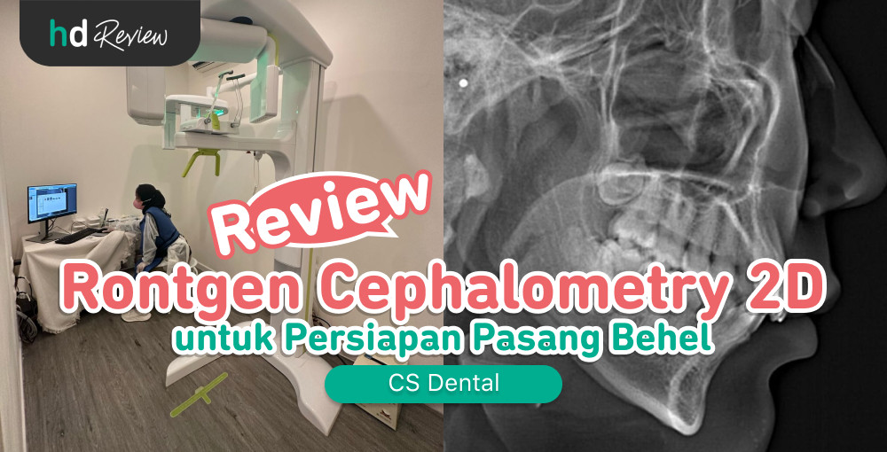 Review Rontgen Cephalometri 2D di CS Dental | HDmall