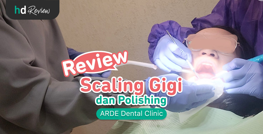 Review Scaling Gigi di ARDE Dental Clinic | HDmall