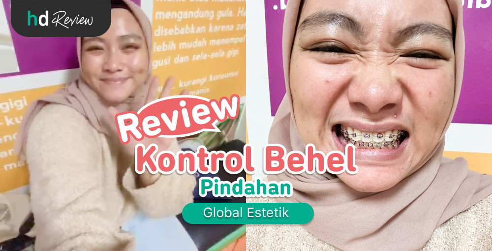 Review Kontrol Behel Pindahan di Global Estetik | HDmall