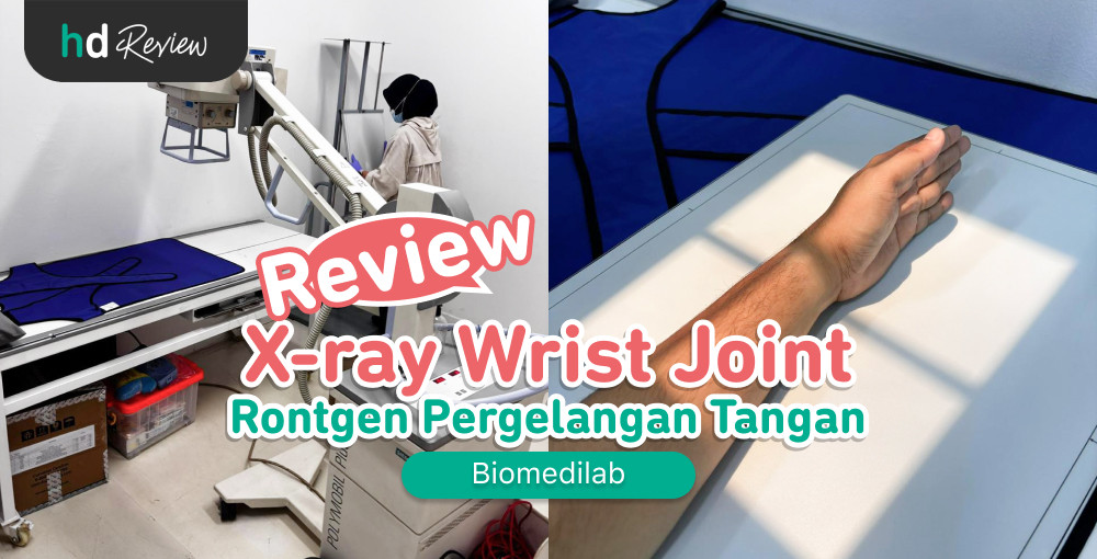 Review Rontgen Pergelangan Tangan di Biomedilab | HDmall